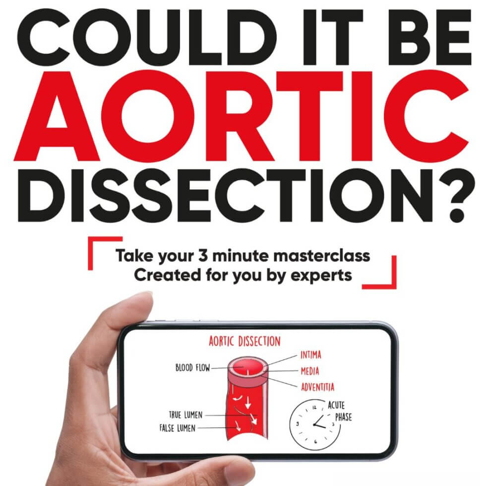 Updated NHS Genomic Screening Guidelines for Aortic Dissection
